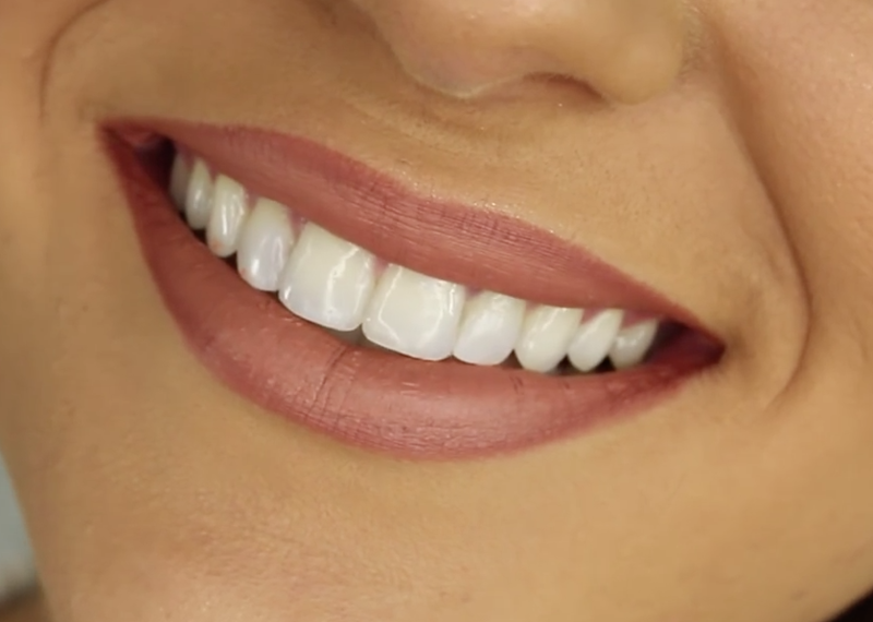 Healthy Smile, Healthy You: The Importance of Good Oral Health | Life ...