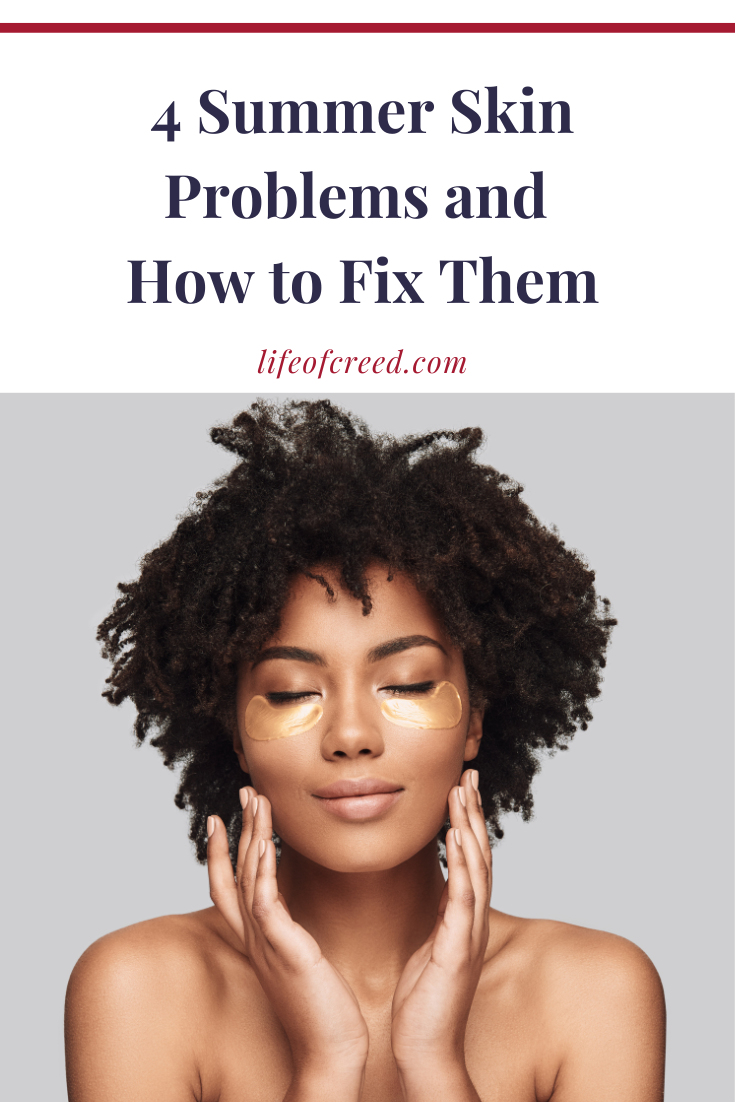 4 Summer Skin Problems And How To Fix Them | Life of Creed